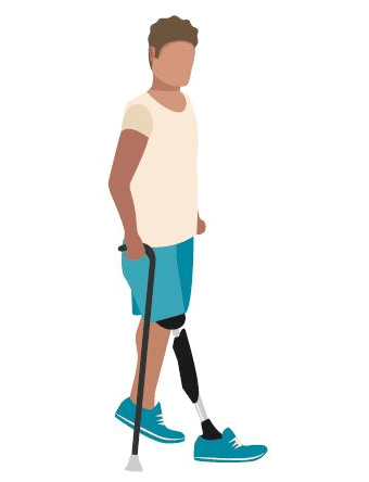 Paul wears the Linx prosthetic limb
